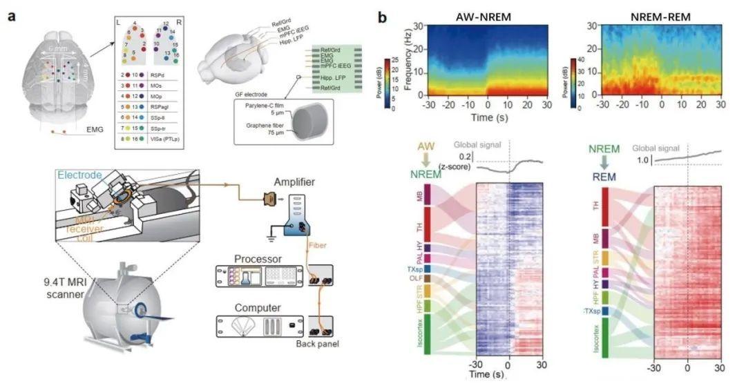 Nature子刊：梁智锋组建立了同时电生理记录的小鼠睡眠fMRI的方法 - 知乎