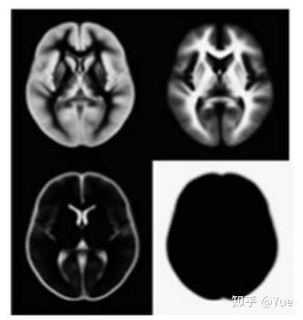 00_医学影像学习_MRI_VBM - 知乎