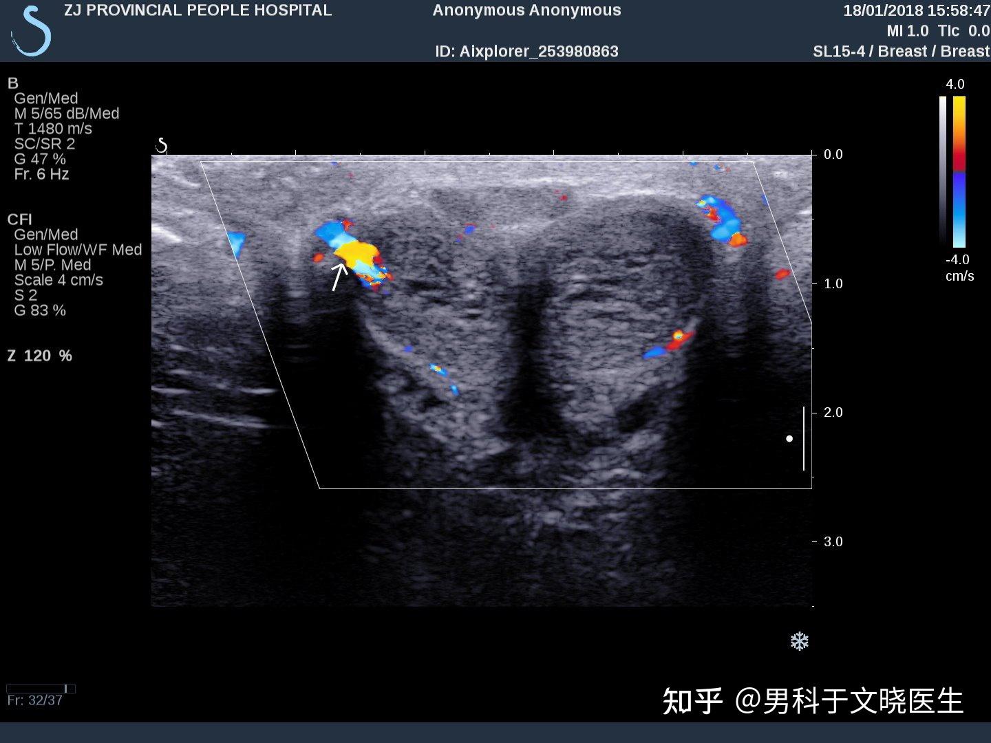 “海绵体血管功能检测”---针对男性勃起功能障碍（ED）患者 - 知乎