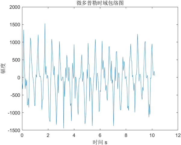 基于xWR1443毫米波雷达的参数估计与微多普勒仿真（MATLAB） - 知乎