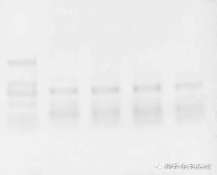 菌落PCR（Colony PCR）应用指南 - 知乎