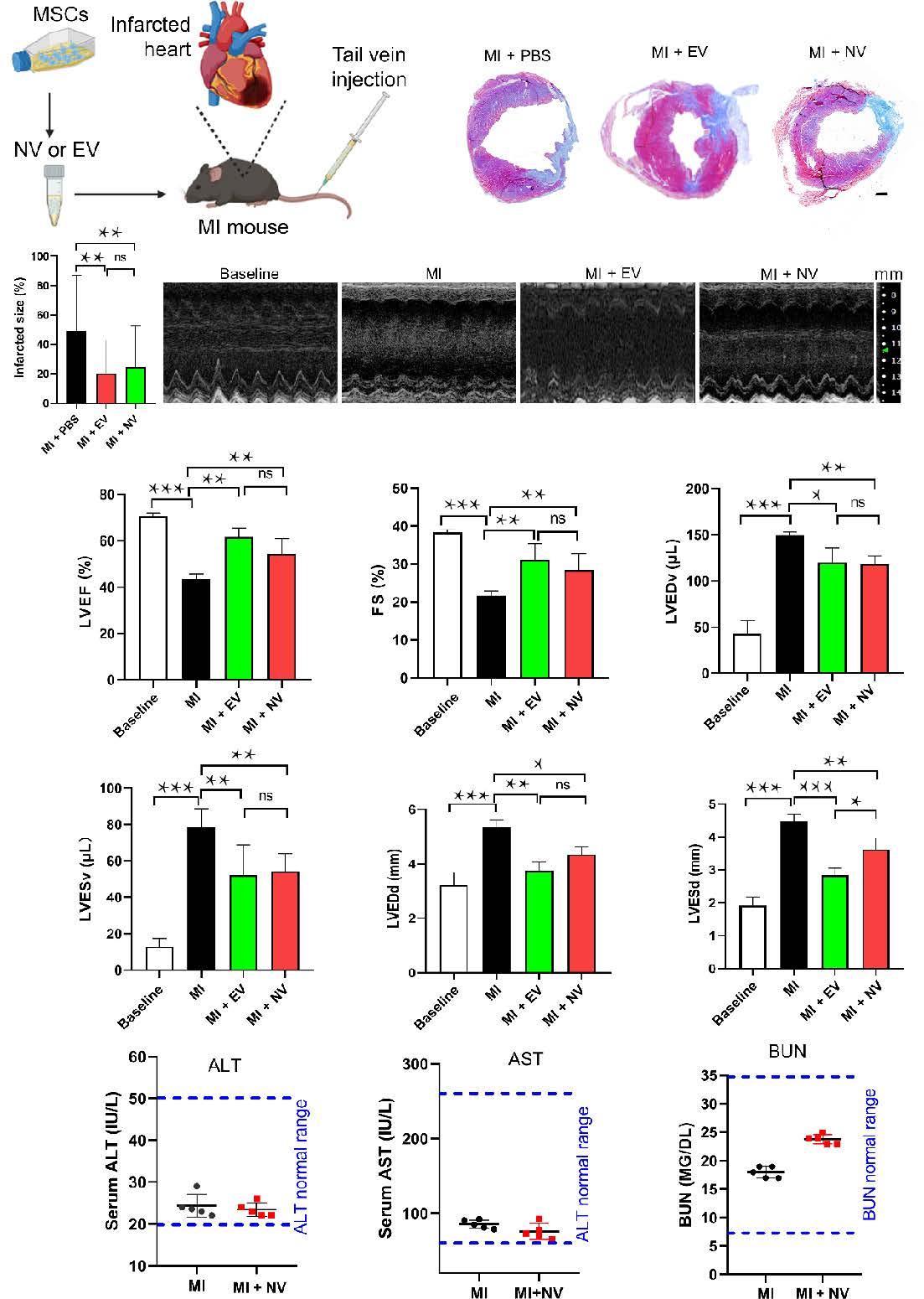 NVs or EVs，哪个更适合疾病治疗？ - 知乎