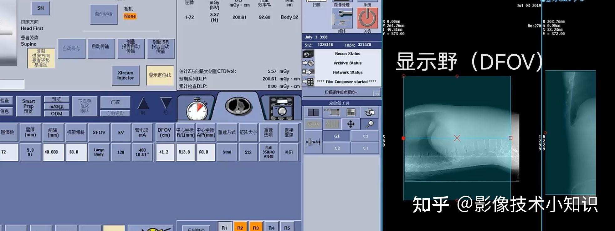 CT的扫描野和显示野 - 知乎