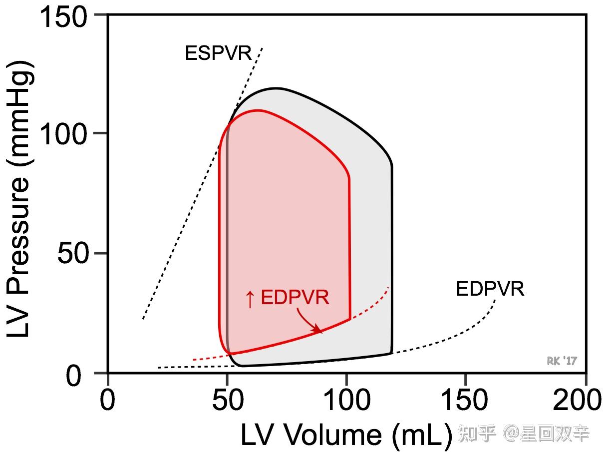左心室压力-容积环（Left ventricular pressure-volume (PV) loops） - 知乎