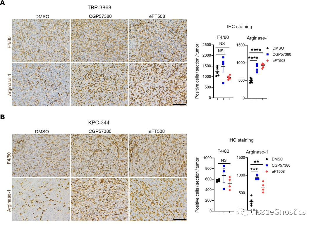 JCI Insight| 通过巨噬细胞调控CD8+T 细胞肿瘤免疫的新机制 - 知乎
