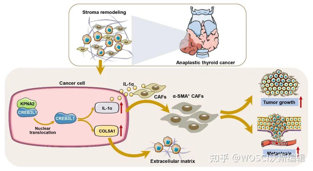 Mol Cancer | 浙江省人民医院揭示CREB3L1塑造肿瘤基质微环境促进未分化甲状腺癌进程的新机制 - 知乎