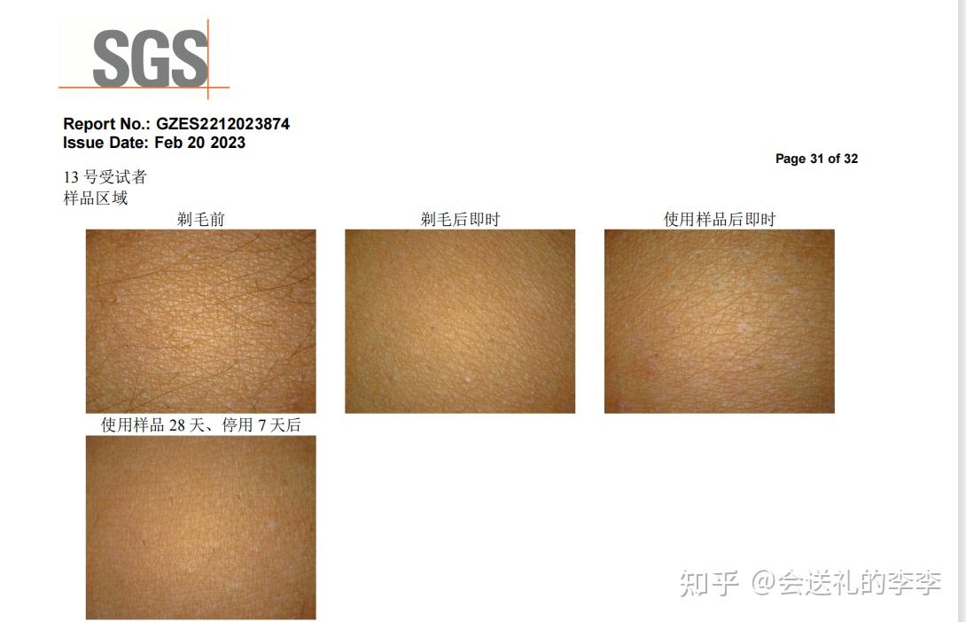 技术不输ulike，全网在夸的beautigo脱毛仪真实测评，据说还是性价比天花板！ - 知乎