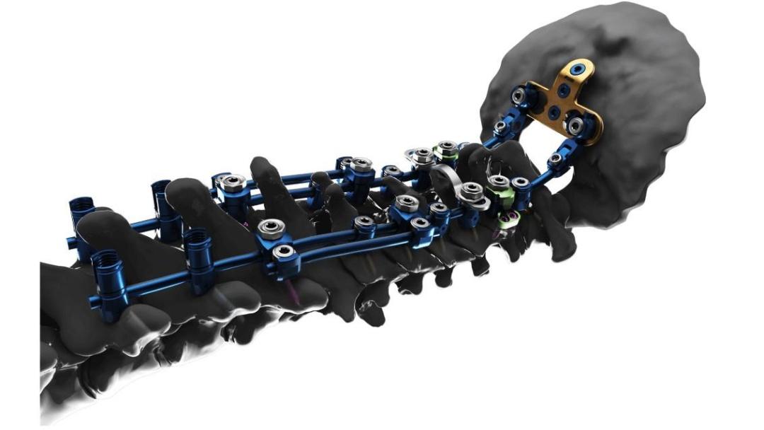 一文盘点强生骨科前世今生 - 知乎