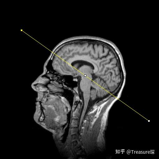 ImageJ实用教程——3D Stack Reslice(基本功能篇) - 知乎
