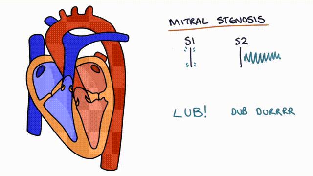 心音的奥秘-NO.1 - 知乎