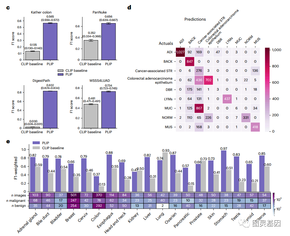 Nat Med | 斯坦福医学院利用医疗 Twitter 进行病理图像大模型分析 - 知乎