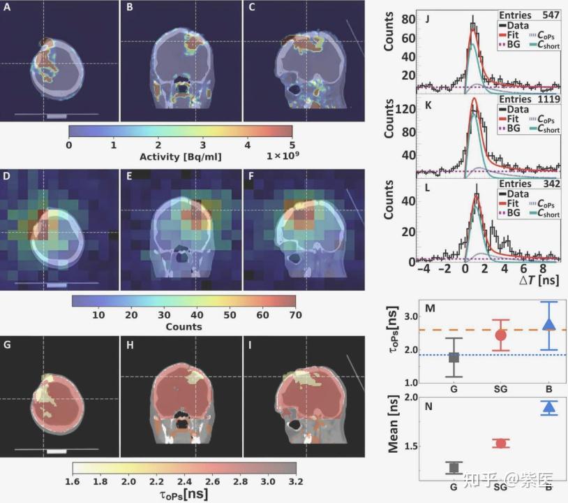 三光子成像？开辟PET诊断新纪元！ - 知乎
