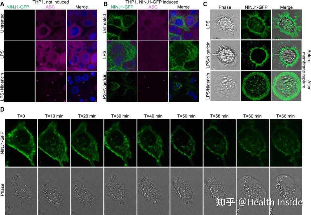 NINJ1通过切割和释放膜盘介导质膜破裂 - 知乎