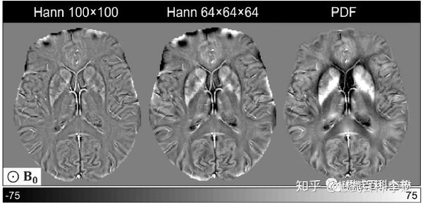 SWI序列原理及临床应用 - 知乎