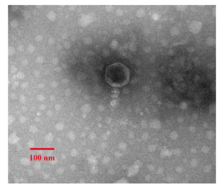 【派森诺项目文章】新型噬菌体的分离、鉴定与全基因组测序研究 - 知乎