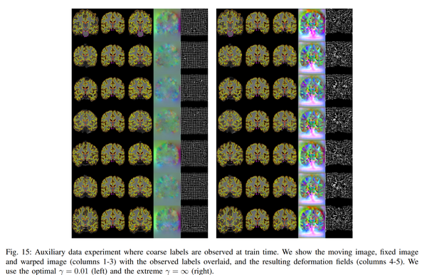 【论文速递11-8】医学图像配准方向优质论文及其代码 - 知乎