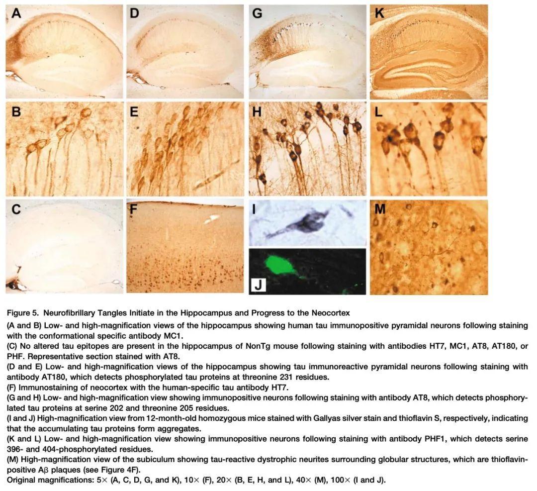 3xTg-AD（三转小鼠）— 阿尔茨海默症模型 - 知乎
