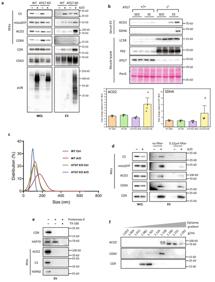 线粒体自噬机制、自噬性分泌、炎症反应 - 知乎