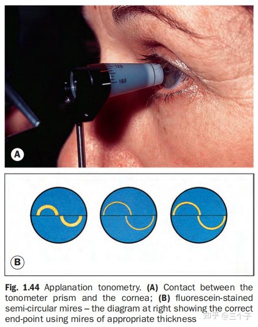 No.21, Tonometry(1),Goldmann tonometry - 知乎
