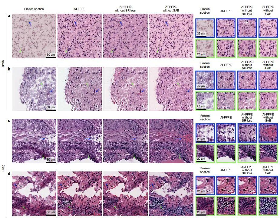 Nat Biomed Eng | 将组织图像从冷冻切片转变为FFPE的深度学习模型 - 知乎