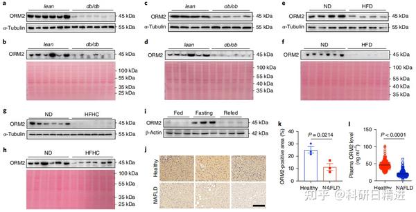 Nature metabolism丨肝脏因子ORM2通过抑制脂肪从头生成维持肝脏脂质稳态 - 知乎