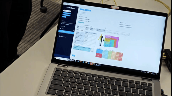 ADI ADPD7000发布 让可穿戴设备VSM检测更准确 - 知乎