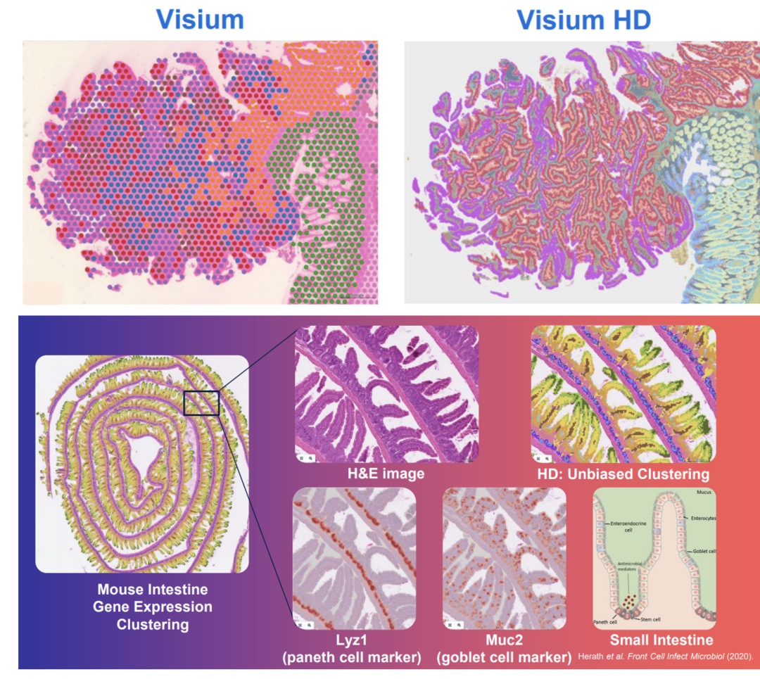 预售开启丨10x Visium HD高分辨空间转录组技术震撼发布，推动空间组学进入单细胞高清时代 - 知乎