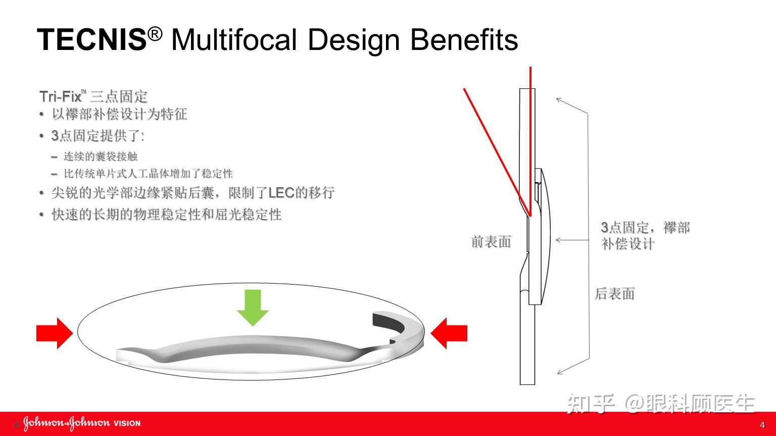 眼力健双焦点人工晶体-ZMB00的特点 - 知乎