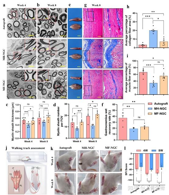 清华大学孙伟课题组《Adv. Sci.》：研发3D打印导电多尺度纤维支架，加速外周神经损伤修复！ - 知乎