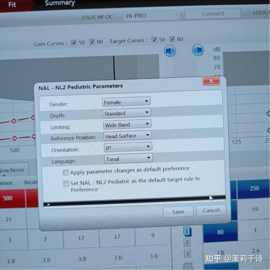 自己调试助听器-2-调试软件使用 - 知乎