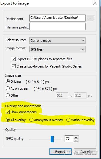 dcm文件怎么打开？ - 知乎