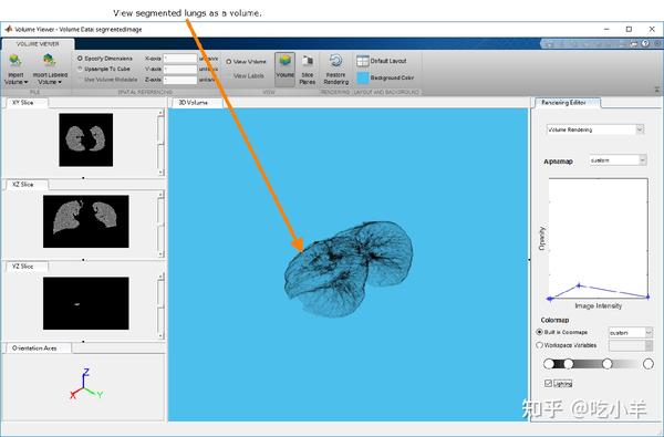 MATLAB图像处理：89：从 3-D 胸部扫描中分割肺 - 知乎