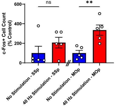 MIT蔡立慧团队最新报道40Hz震动刺激改善AD病理和运动表现 - 知乎