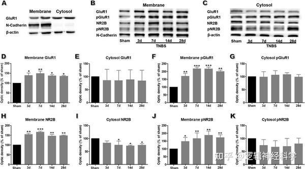 Neurosci Bull︱李云庆课题组揭示前扣带回内神经可塑性改变与慢性胰腺炎的痛觉过敏和焦虑有关 - 知乎