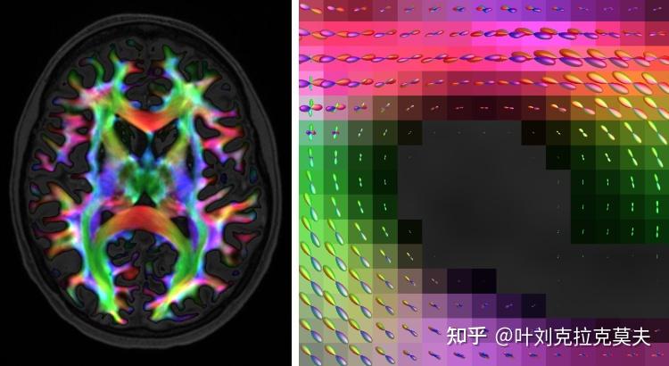 科学可视化软件介绍 – 医学图像处理和可视化开放软件框架MRtrix3 - 知乎