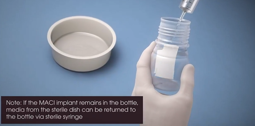 创新氟聚合物包装技术助力细胞治疗产品——Vericel MACI®与Savillex Purillex® PFA瓶的成功合作案例 - 知乎