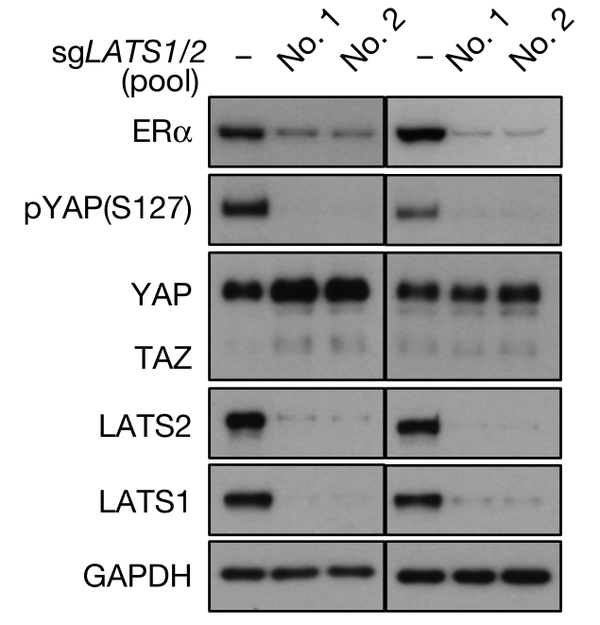 一场关于乳腺癌细胞命运决定的争论：LATS1/2究竟如何调控ERα？ - 知乎