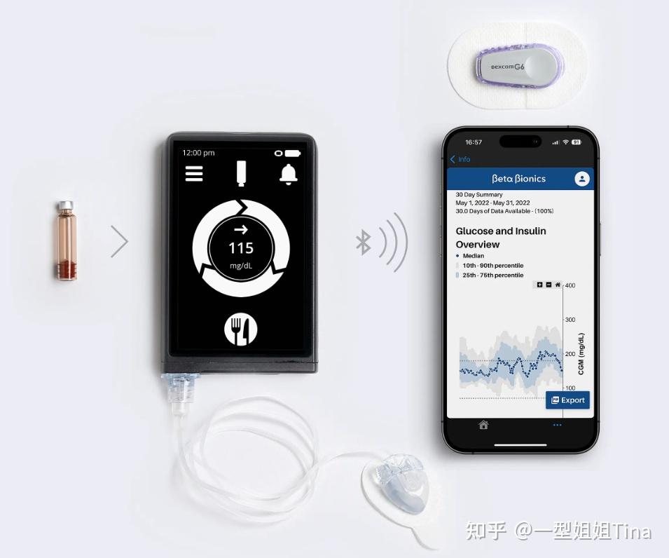 终于等到你！全自动仿生胰腺iLet经FDA获批上市！ - 知乎