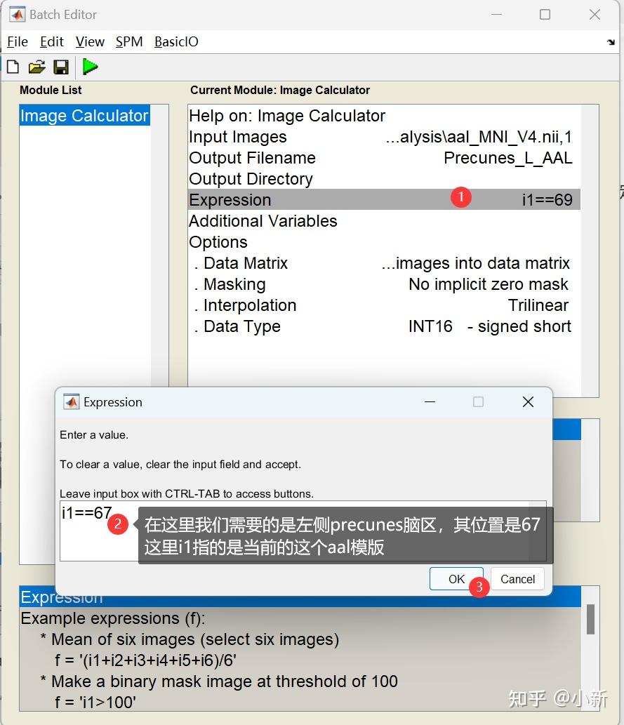 15（2）SPM-fmri任务态 制作ROI mask（客观模版） - 知乎