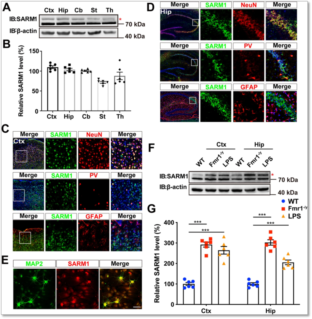 Cell DeathDis｜杭州师范大学黄智慧/温州医科大学汪伟团队发现SARM1蛋白在自闭症谱系障碍发病中的新机制 - 知乎