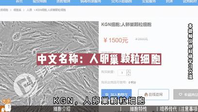 KGN细胞培养，人卵巢颗粒细胞培养攻略 - 丰晖生物 - 知乎