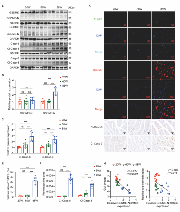 Cell Death Discov︱福医大附院谢良地团队揭示肌少症中TNF-α调控骨骼肌细胞发生细胞焦亡的分子机制 - 知乎