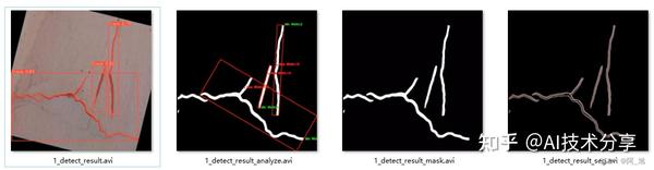 基于yolov8深度学习的智能道路裂缝检测与分析系统【python源码pyqt5界面数据集训练代码】深度学习实战、目标检测、目标分割 知乎