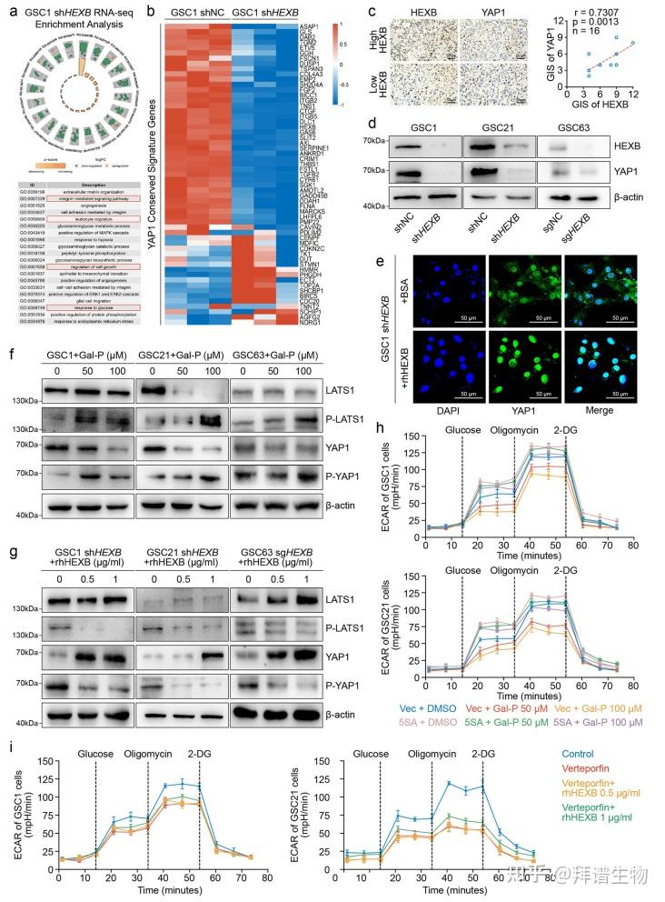 项目文章 Nat Comm（IF=14.7）｜HEXB促癌细胞与巨噬细胞共依赖，加速胶质母细胞瘤形成 - 知乎