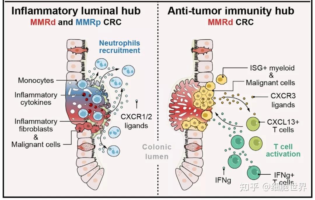 Cell | 结直肠癌中发现空间性免疫枢纽 - 知乎