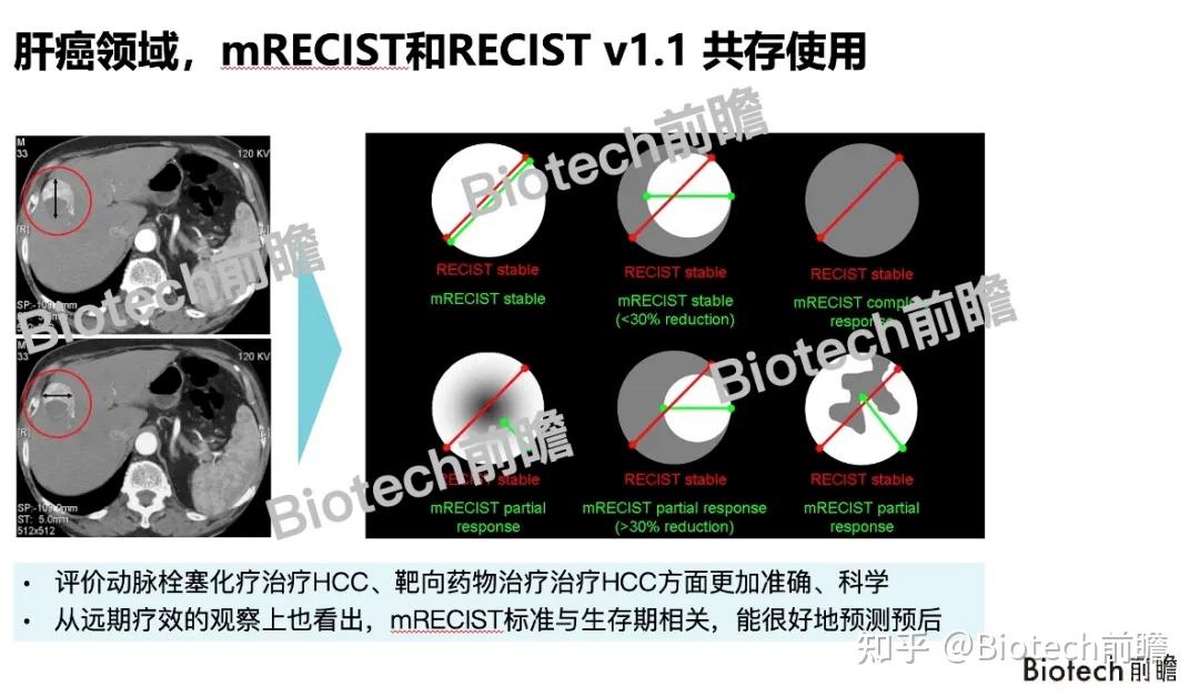 试验设计课堂丨读懂实体瘤疗效（RECIST1.1、mRECIST等）评估 - 知乎