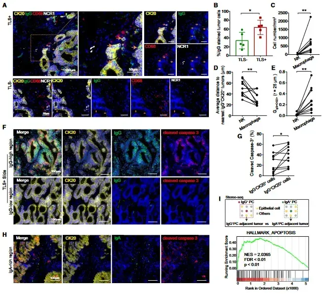 Cancer Cell | Stereo-seq助力揭示三级淋巴结构在结直肠癌肝转移中的抗肿瘤机制 - 知乎