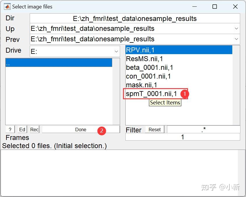15（1）-SPM-fmri任务态 结果查看与汇报 xjview - 知乎