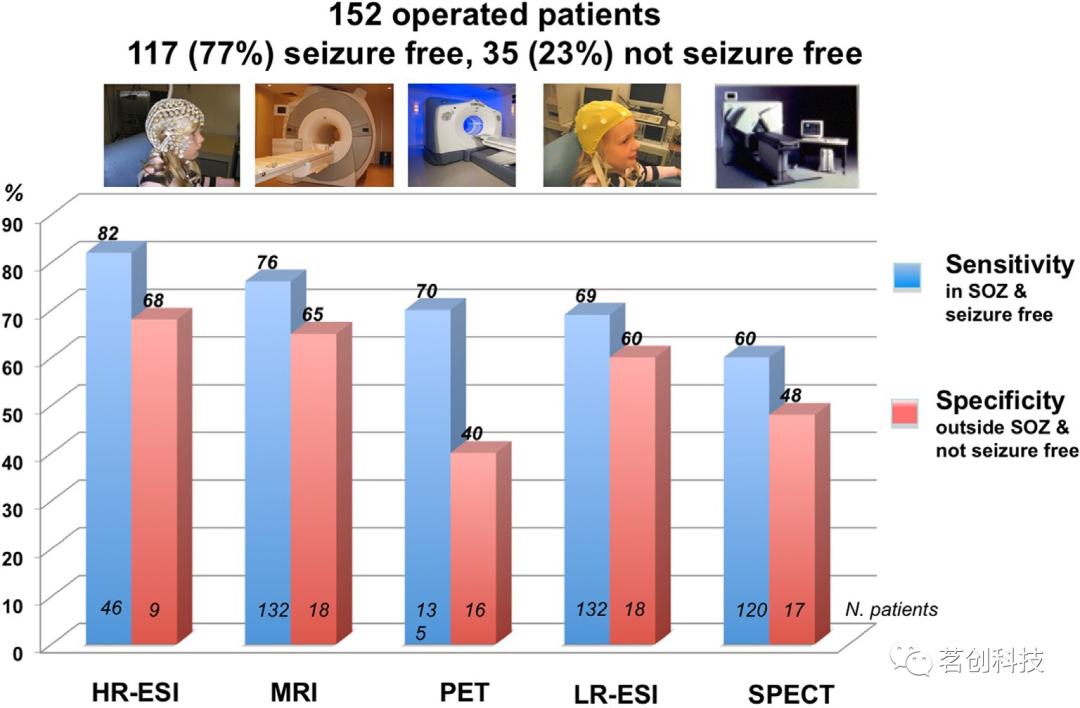 EEG源定位 - 知乎