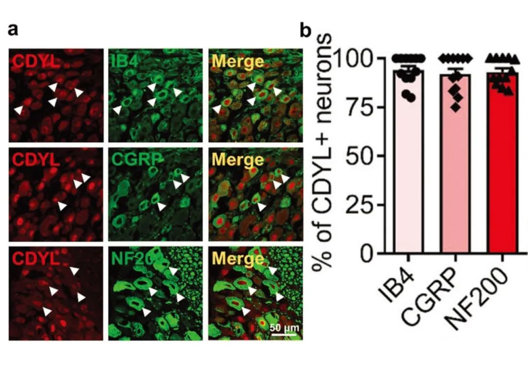 IF=17.521【客户文章】Adv Sci：北京大学基础医学院王韵教授团队揭示痛觉表观调控新机制，并开发新型镇痛药 - 知乎